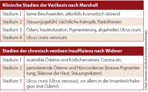 Venenerkrankung - Das venöse Ödem oder Phlebödem