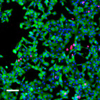 Beta-Zellen - Vier Gene beeinflussen die Teilungsfähigkeit ...
