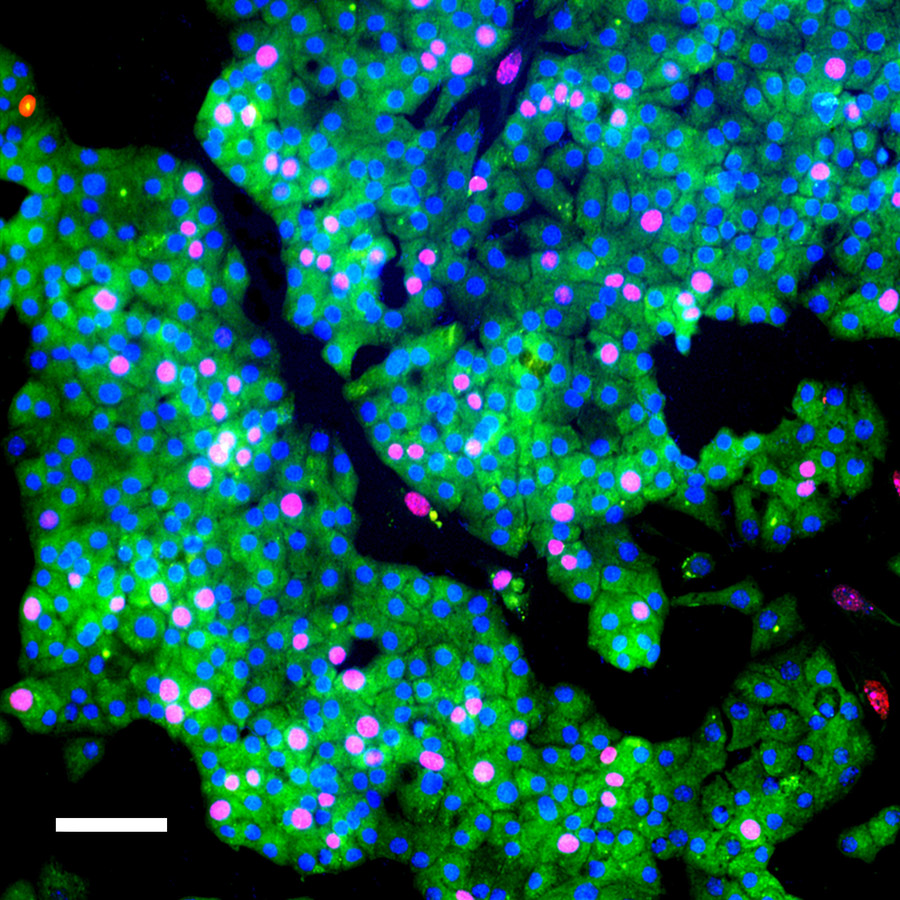 Beta-Zellen - Vier Gene beeinflussen die Teilungsfähigkeit ...